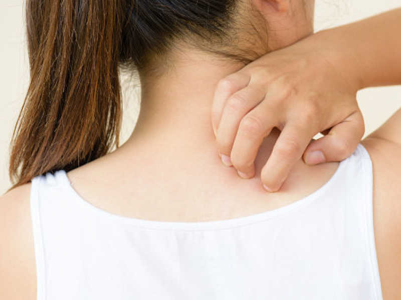 Apa Itu Jamur Ringworm: Kenali Penyebab dan Gejalanya Pada Manusia dan ...